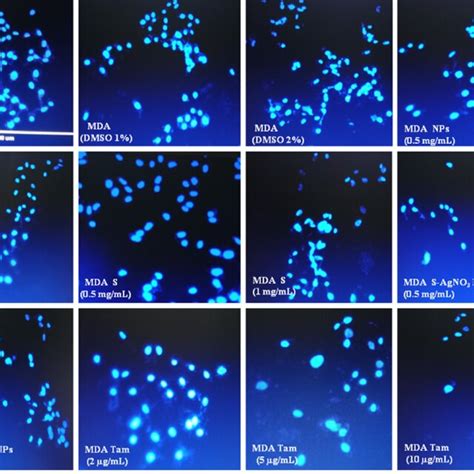Photomicrographs Of Mda Mb 231 Cells Stained With Dapi Dye Studied By