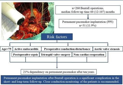 Risk Of The American Association For Thoracic Surgery Aats