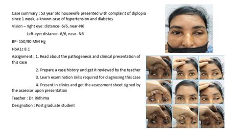 Paralytic Squint Case Pdf