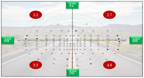 Example Of An Esterman Binocular Visual Field Test Printout Green