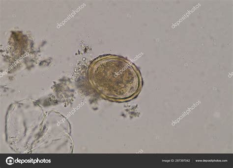 Roundworm Eggs In Stool