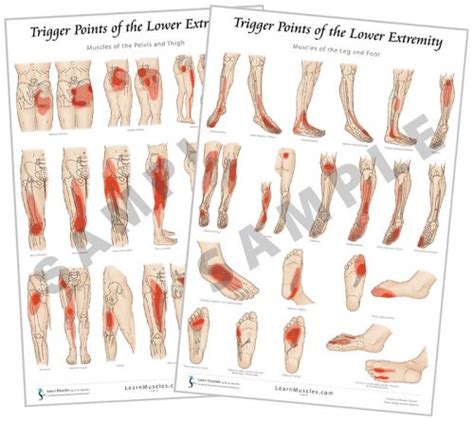 Trigger Point Poster Lower Extremity Terra Rosa Online