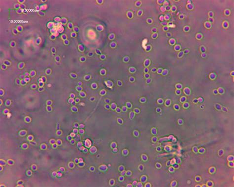 곰팡이 균사균사체포낭포자 현미경사진 네이버 블로그