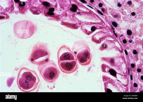 Prophase 1 Meiosis Microscope Microscope Prophase 1 Meiosis
