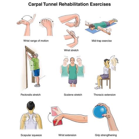 Cubital Tunnel Syndrome Exercises