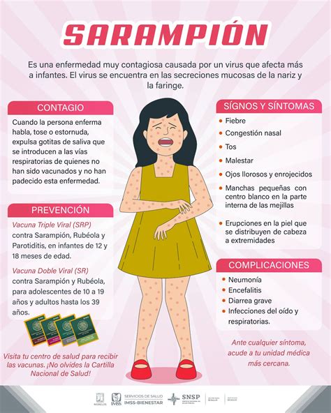 Comparte Hnm Información Sobre Síntomas De Sarampión Zona Centro Noticias
