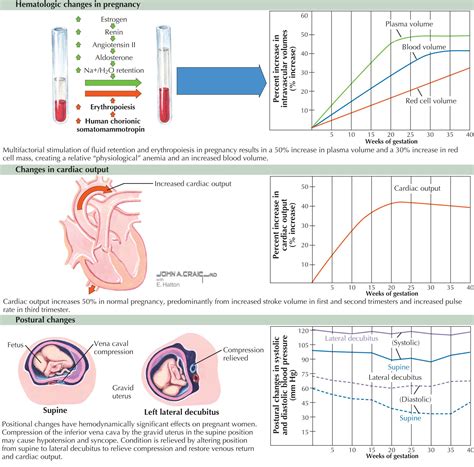 Cardiovascular Disease In Pregnancy Clinical Tree
