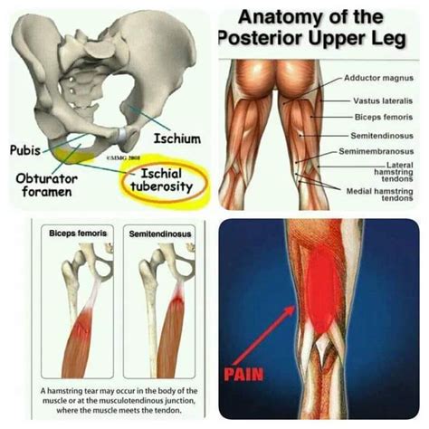 Ischial Tuberosity Muscles