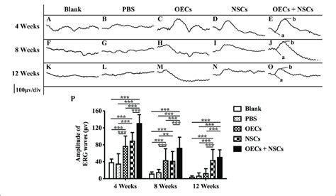 Electrophysiological Improvement After Combined Transplantation Of