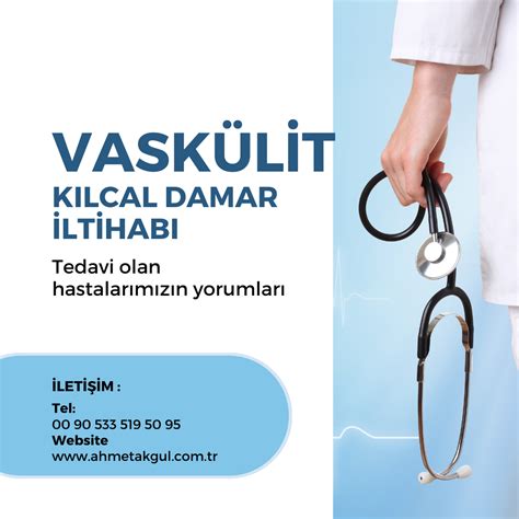 Vaskülit Tedavisi Hasta Yorumları 11 Prof Dr Ahmet AkgÜl İç Varis