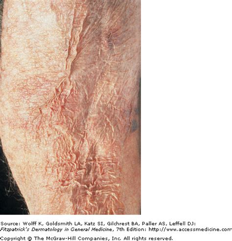 Terms Mizzou Derm Learning Modules