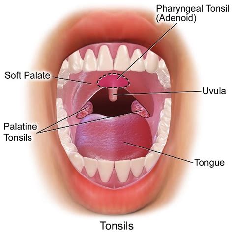 Tonsillitis Geeky Medics