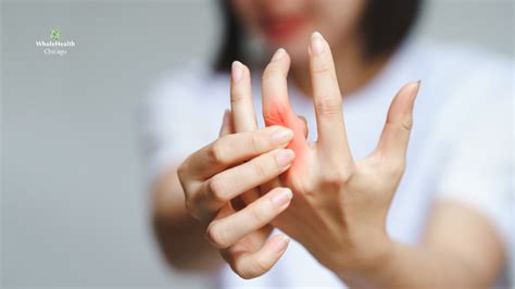 Rheumatoid Arthritis Antibiotics And Your Gut Microbiome