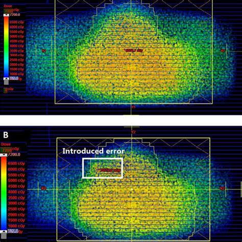 Illustration For The Dose Error The Dose Distribution Of The Fourth