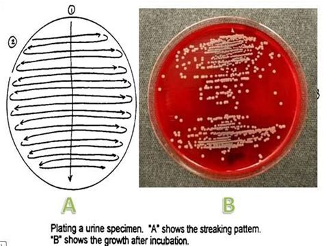 Streaking Pattern Of Urine Specimen Urinal Medical Laboratory Specimen