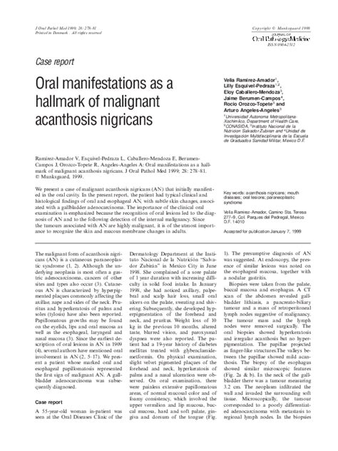 Pdf Oral Manifestations As A Hallmark Of Malignant Acanthosis Nigricans