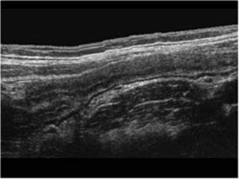 Abdomen And Retroperitoneum 16 Gastrointestinal Tract Case 163