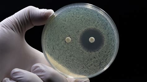 Can I Get A Uti From Sex