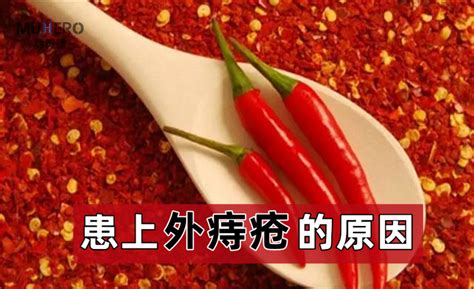 患上外痔疮的原因 知乎