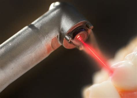 21 Amazing Advancements In Modern Dentistry