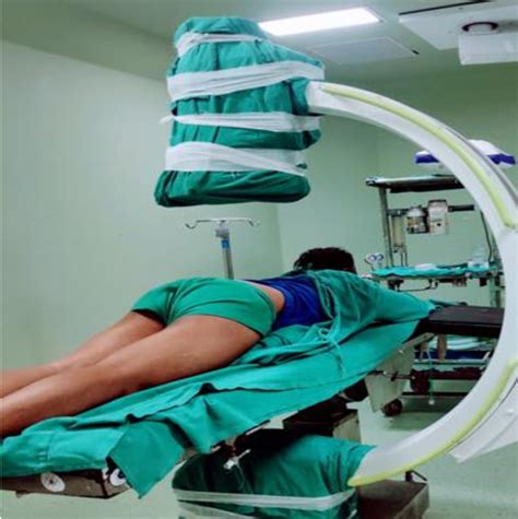 Figure 1 From Outcome Of Transforaminal Nerve Root Block Using