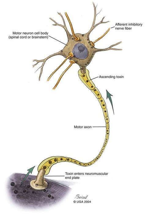 Tetanus Veterian Key