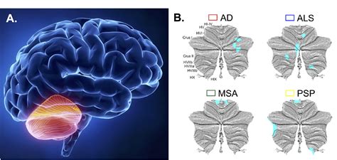 The Cerebellum In Neurodegeneration More Than Just Balance Control