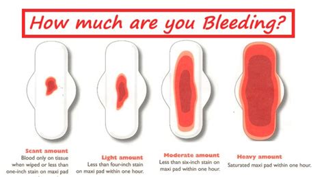 Menstrual Hemorrhage Symptoms