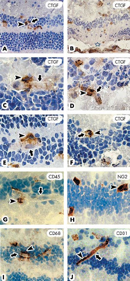 Cryosection Of Human Diabetic Retina Stained For Gfap Showing Staining