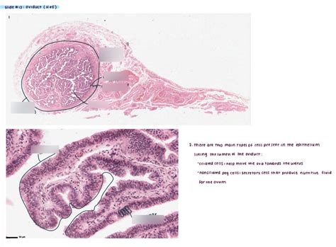 Female Reproduction Histology Slide 12 Diagram Quizlet