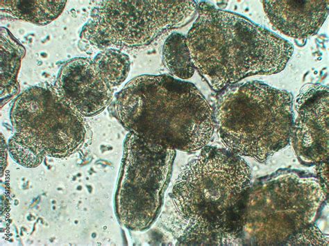 Protoscolices Echinococcus Multilocularis Microscopic Photo Of Being