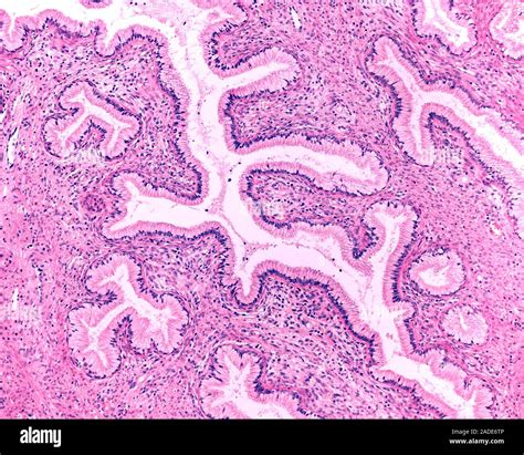 Specimen Description Endocervix At Caitlin Hume Blog