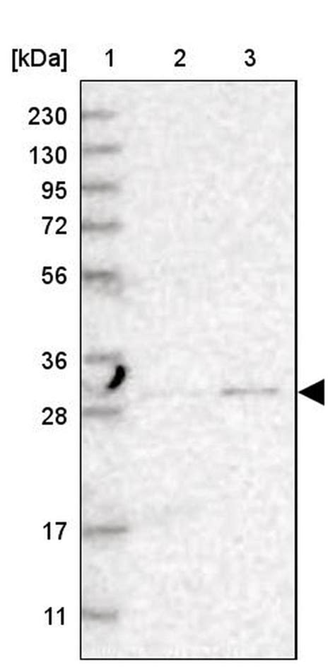 Tpmt Antibody Pa5 54097