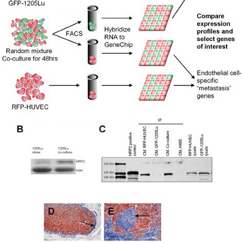 global gene expression profiling of melanoma endothelial cell download high quality