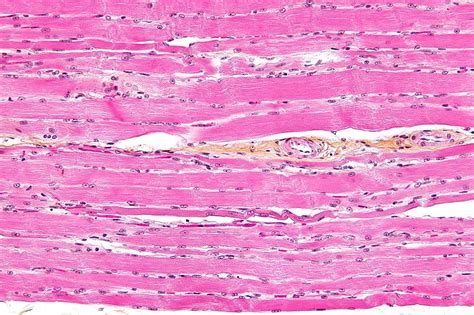 Músculo Estriado Esquelético Tecido Muscular Anatomia Infoescola
