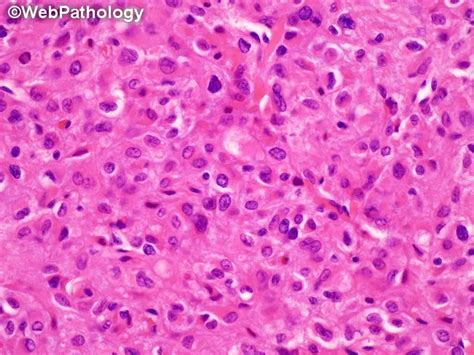 Thecoma Microscopic Features