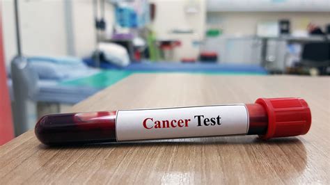 Doctors Take Note Is This A New Era For Cancer Screening North Carolina Medical Society