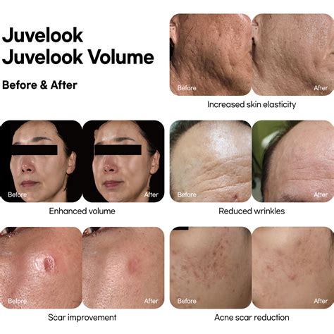 Juvelook Juvelook Volume