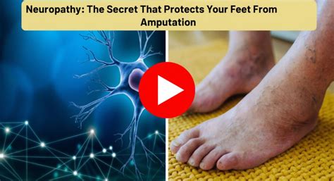 Neuropathy Relief Solution
