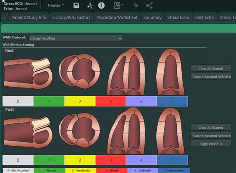 Managing Wall Motion Scoring Diagrams
