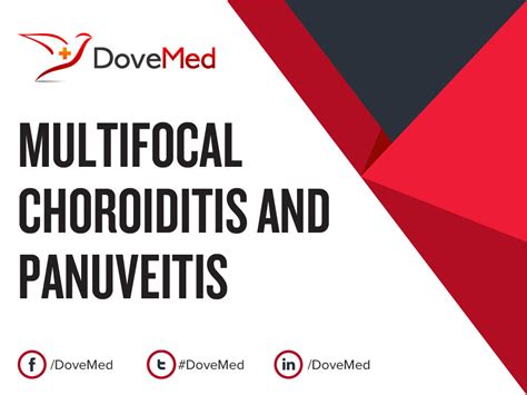 Choroiditis