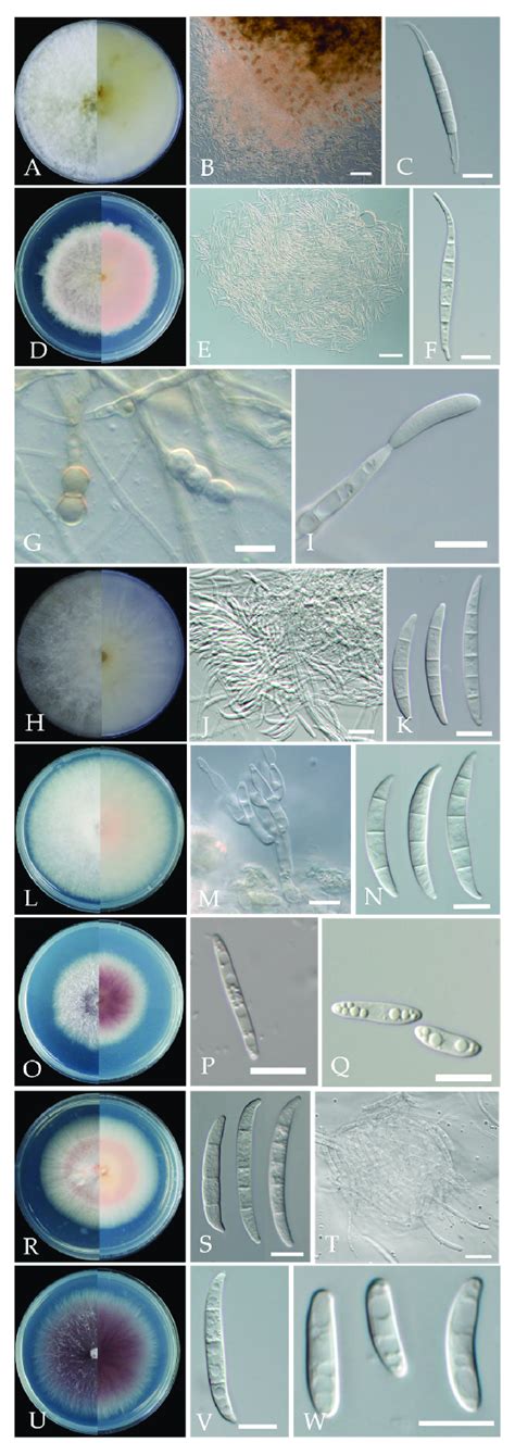 Morphological Characteristics Of Fusarium Species Isolated From Cherry