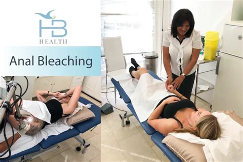 Anal Bleaching At Hb Health Clinic Tracy Kiss