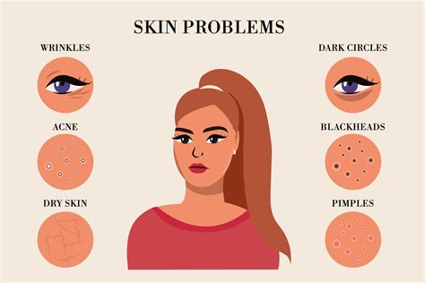Sad Woman And Set Of Most Common Female Facial Skin Problems Needs To