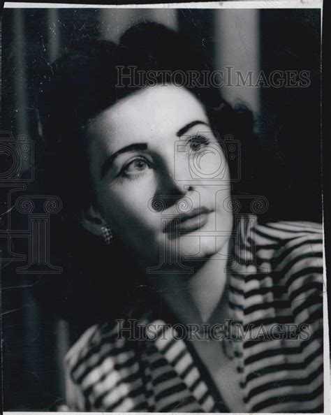 1957 Press Photo Singer Ann Small Burnt In Fire At Her Apartment