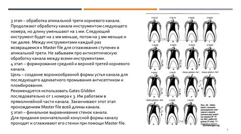 Методика Step Back показания этапы выполнения Преимущества и
