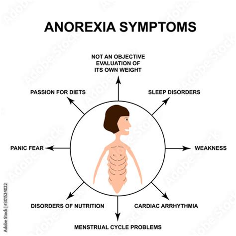 Anorexia Symptoms Slim Physique With Anorexia Infographics Vector