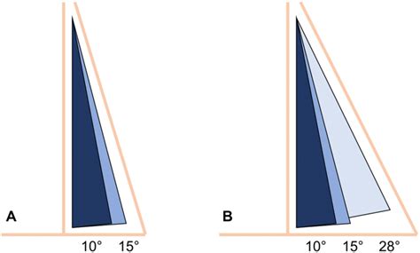 Illustration Of The Nasal Valve Angle A Nasal Valve Angle Of 10° 15° Download Scientific
