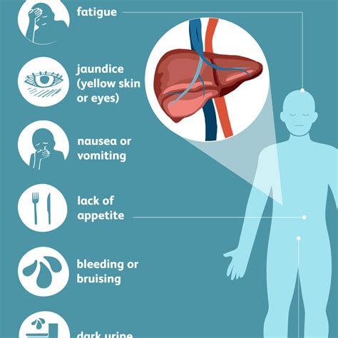 Hepatitis C Virus Signs Symptoms And Complications Hepatitis C Virus Signs Symptoms And Complications