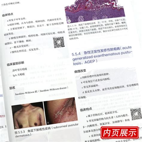 皮肤组织病理学入门实用皮肤组织病理学皮肤病学书籍皮肤科医生的基本知识主要介绍皮肤的组织发生及结构人民卫生出版社虎窝淘